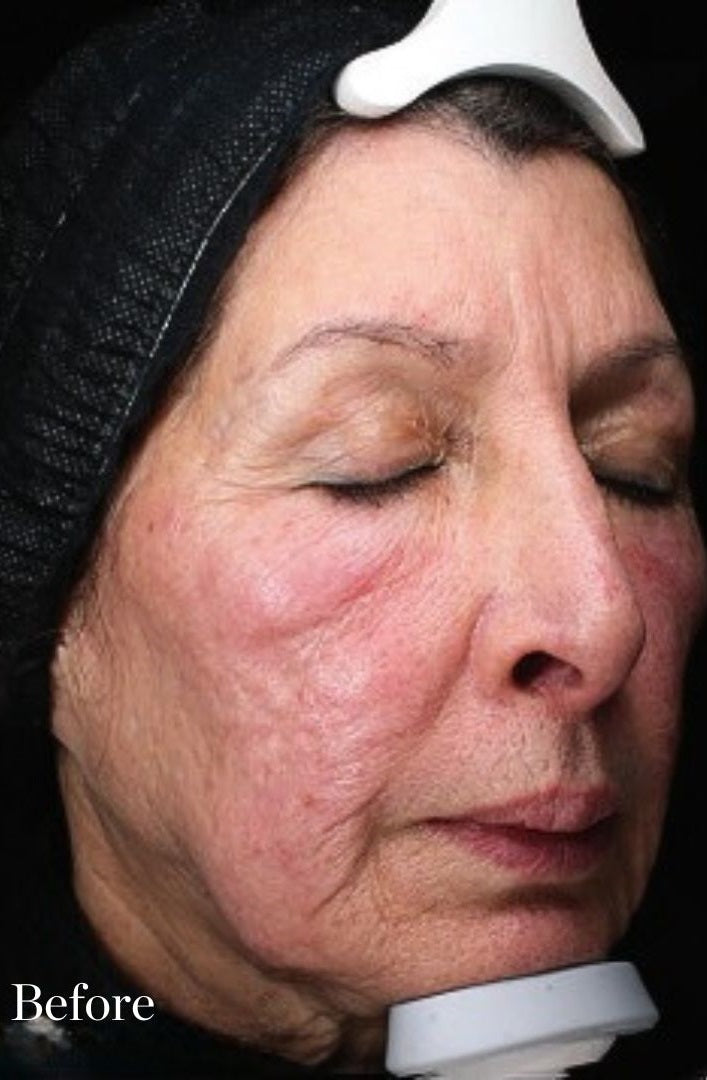 Retinol Serum by iS Clinical UK